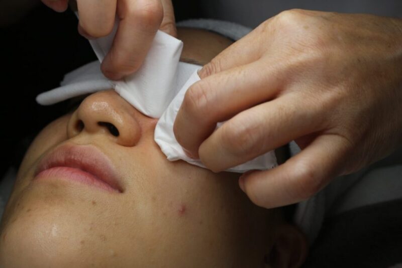 Everything You Need to Know About Facial Extractions » Deenise Glitz